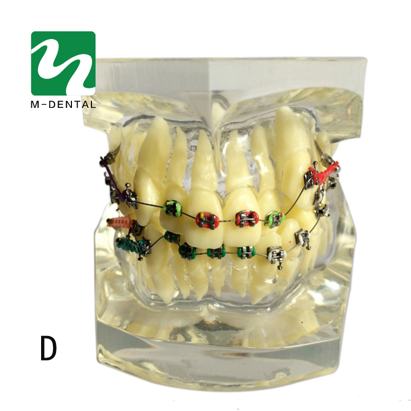 Various Dental Teeth Models Are Used For Teaching ... – Grandado