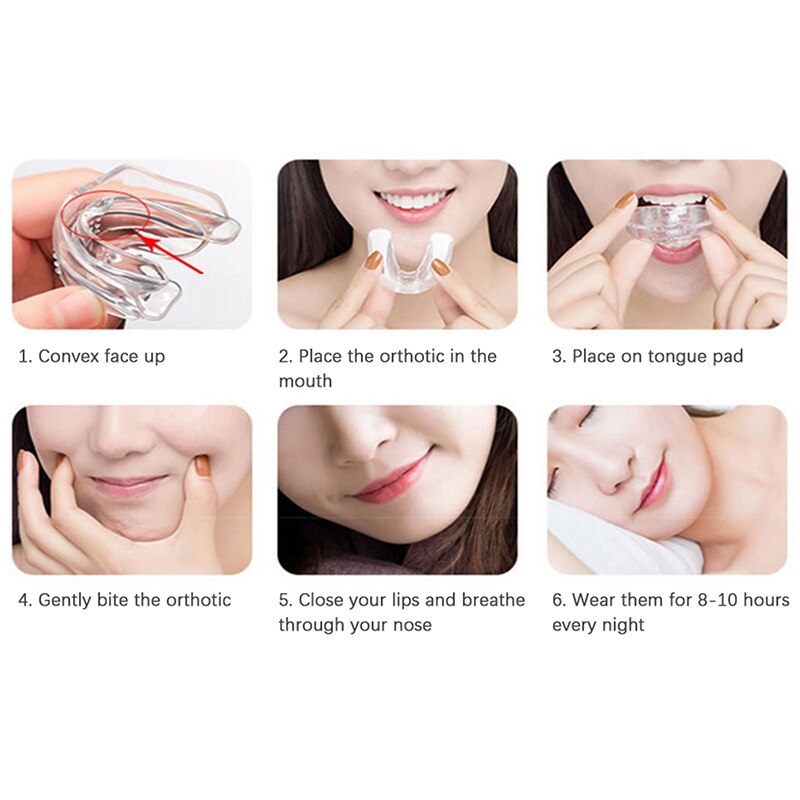 3 Stages Silicone Alignment Trainer Teeth Retainer... – Vicedeal