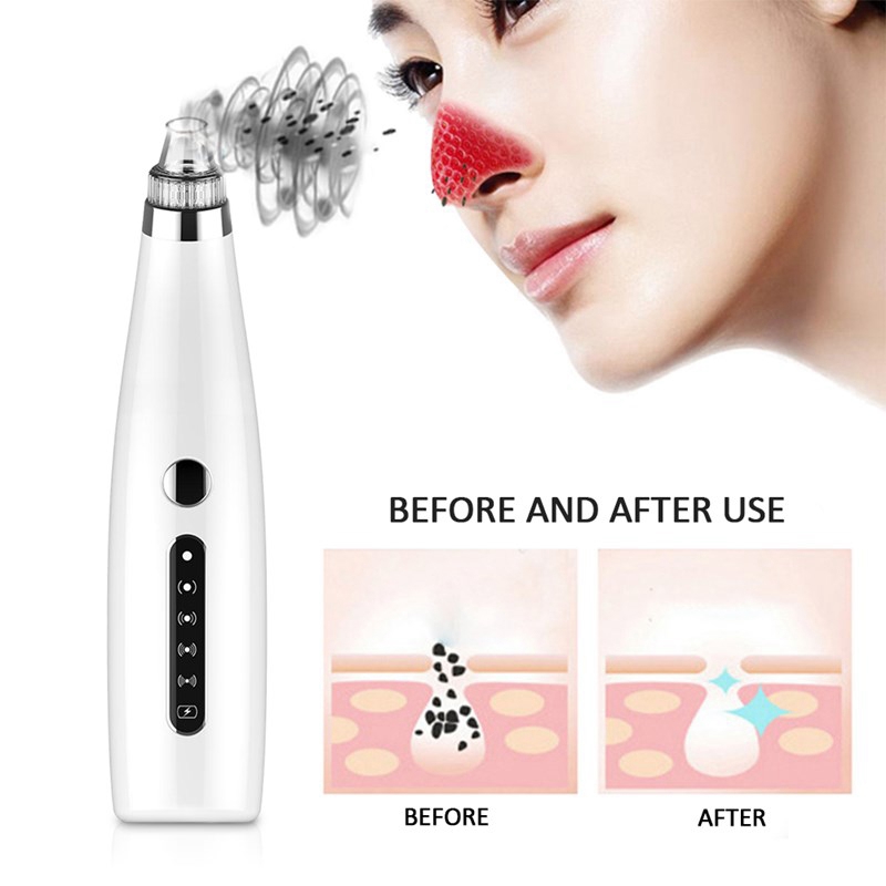 Blackhead Removal Machine Skin Pores Nasal Aspirat... – Vicedeal
