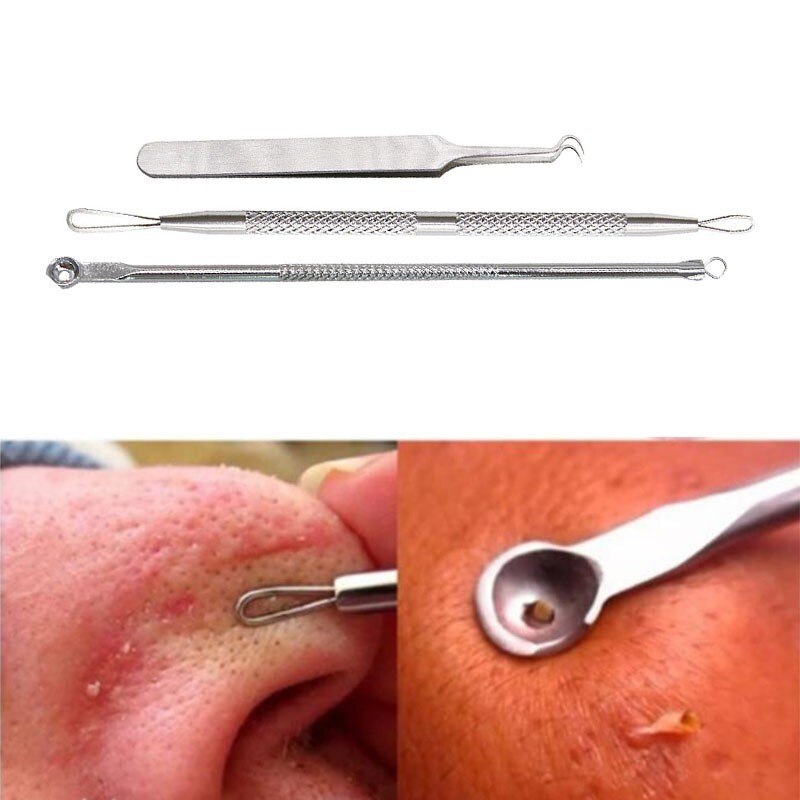 3Pcs Stainless Blackhead Facial Acne Spot Pimple R... – Grandado