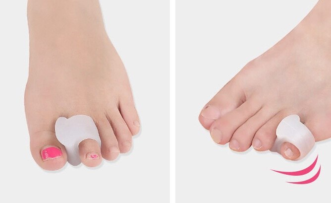 3 pair Soft Silicone Gel Toe Separator Hallux Valg... – Vicedeal