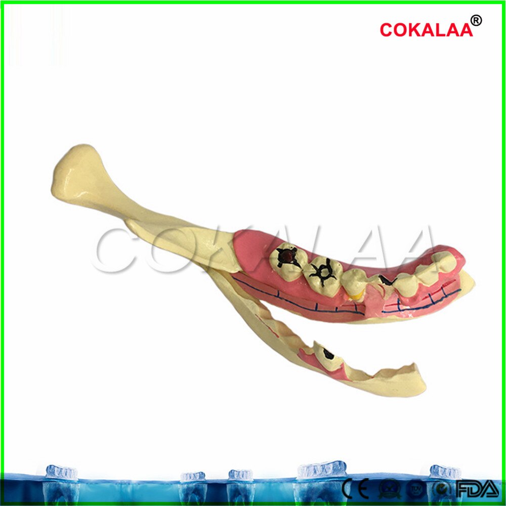 Good Mandibular tissue decomposition model dental ... – Grandado