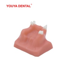 Dental Model Teeth Implant Practice Model Maxillar... – Grandado