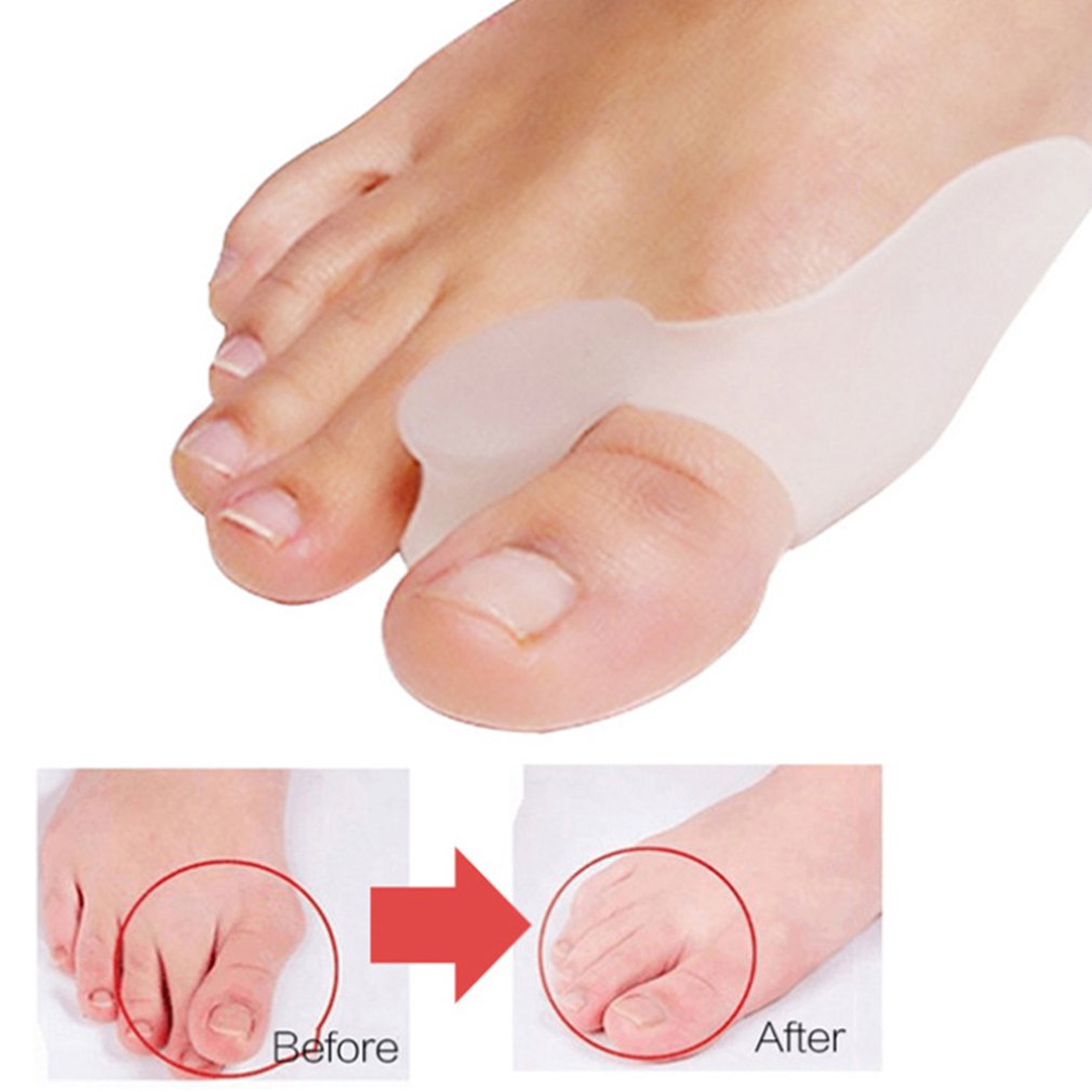 10Pcs Bunion Kussen Protector Bunion Corrector Pad... – Grandado