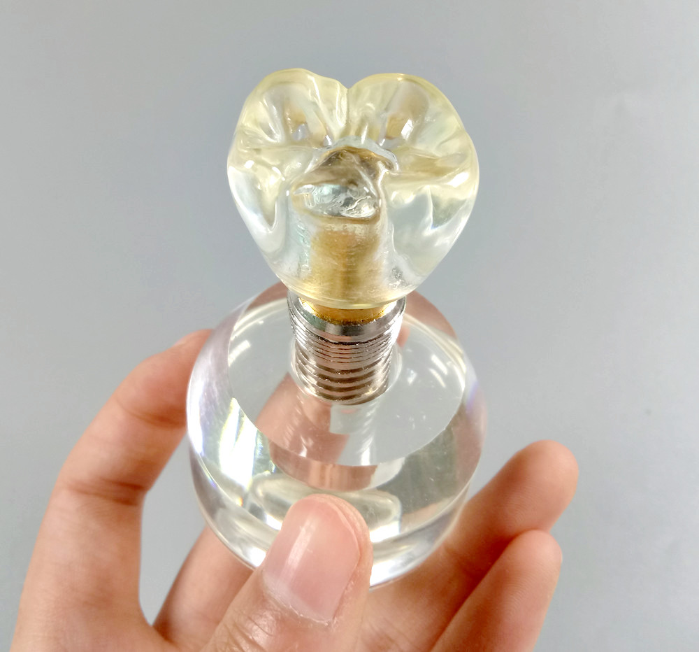 Dental Study Model Abutment Teeth Crown Teaching S... – Grandado