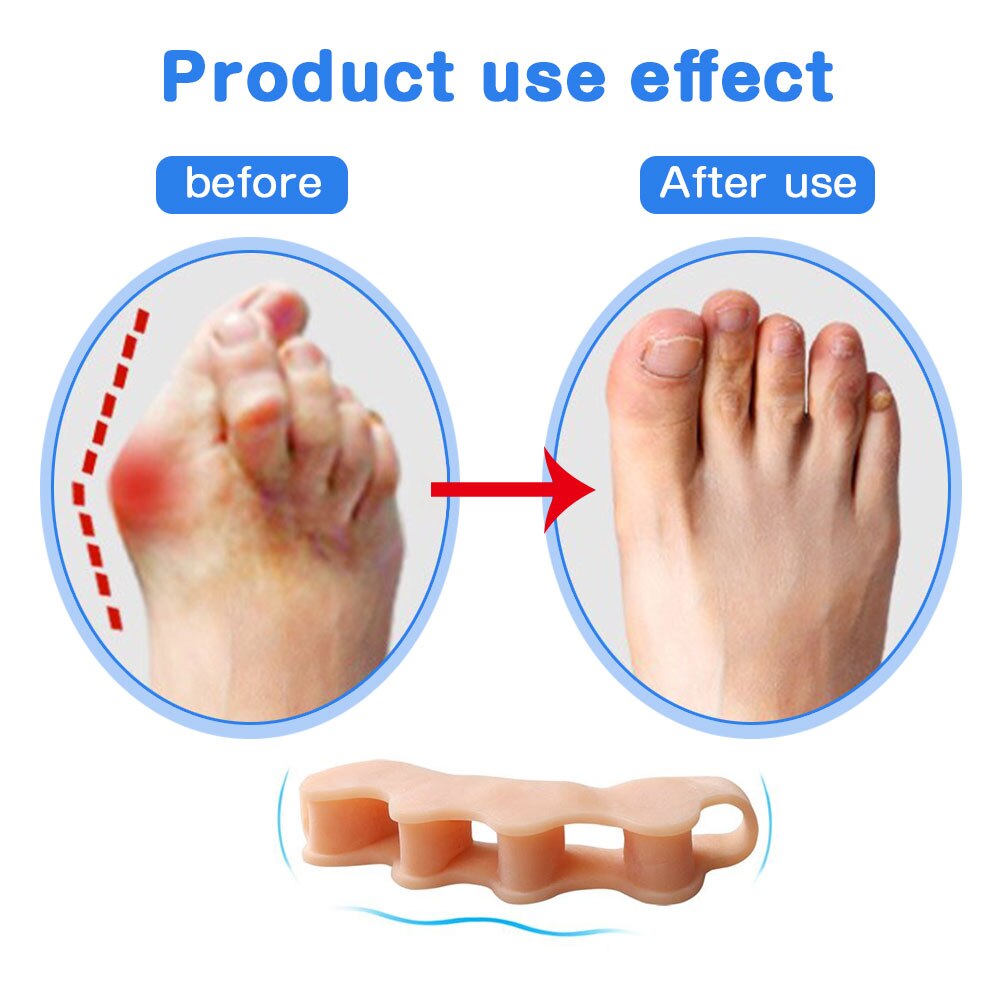 Dighealth 5 Holes Silicone Pedicure Foot Care Fixe... – Grandado