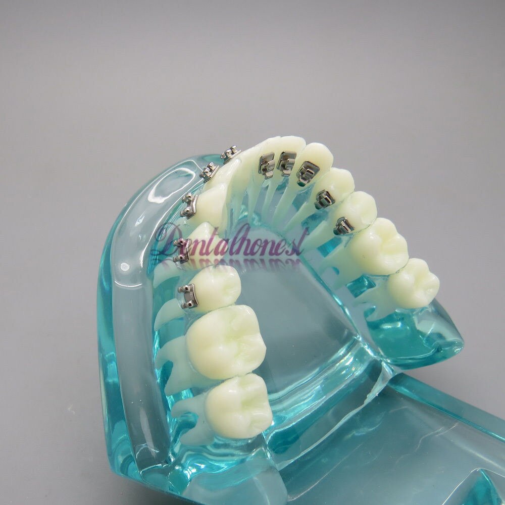 BLUE Dental Orthodontics Communication Model With ... – Grandado