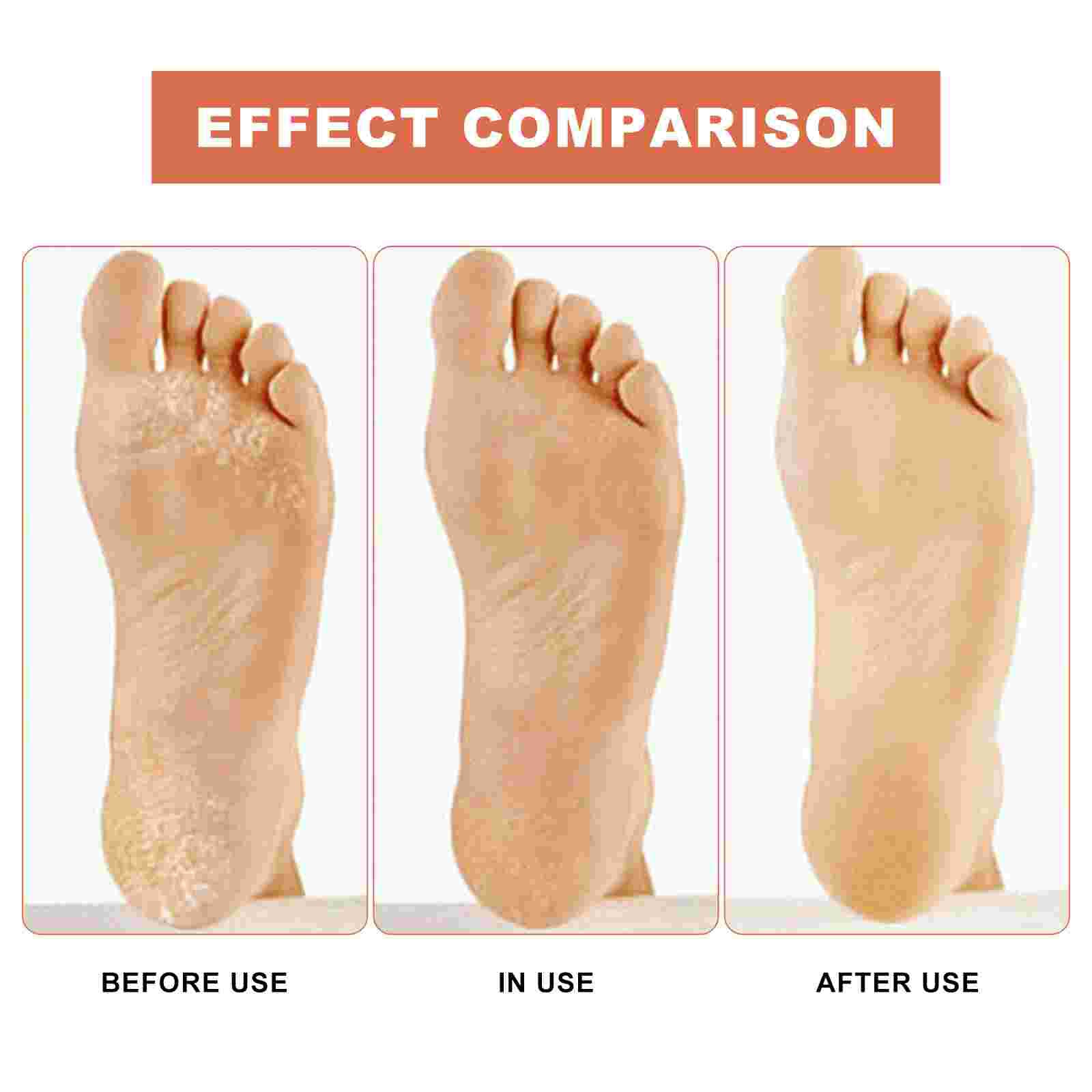 Nano Glass Callus Remover Foot File Coarse Foot Ra... – Vicedeal