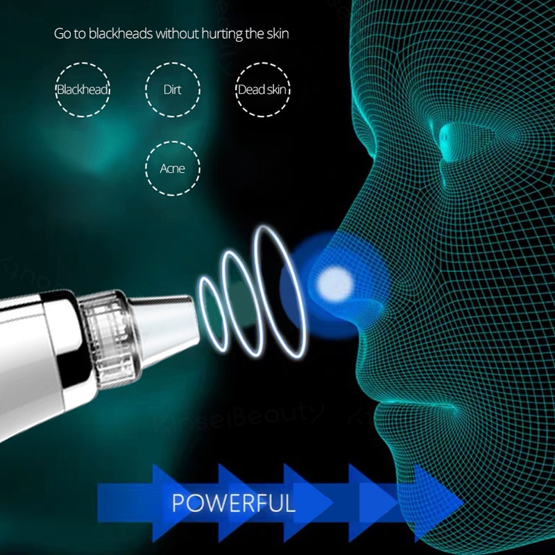 Face Nose Acne Black Dot Remover Vacuum Pore Clean... – Vicedeal