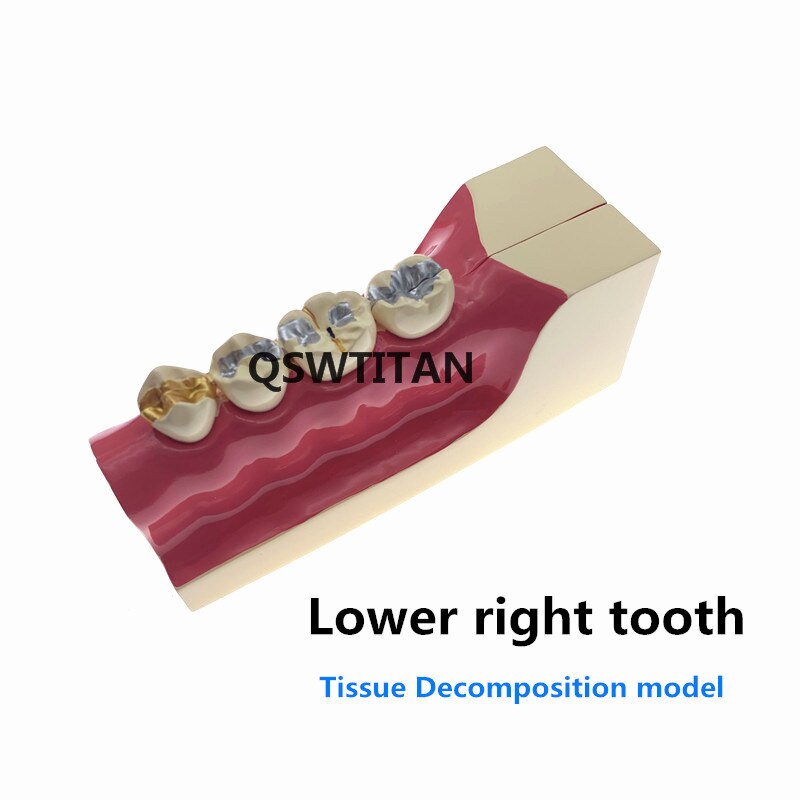 Teeth Anatomy Study Model Molar Cross Section Deco... – Vicedeal