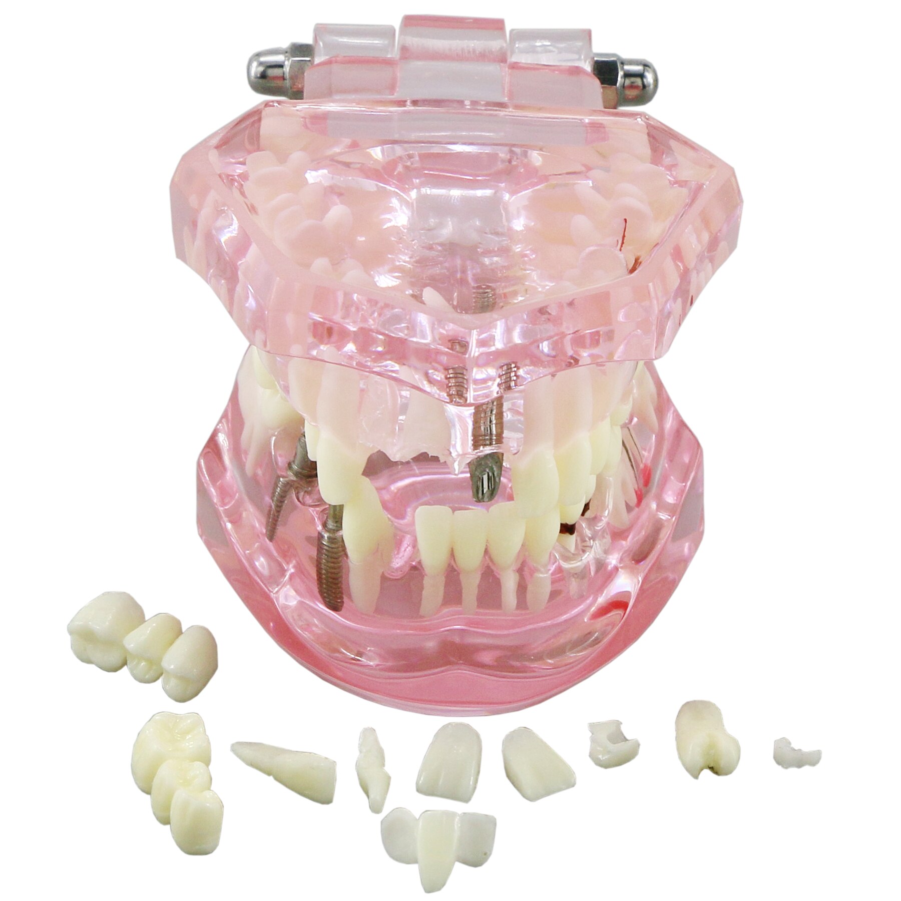 Dental Teeth Tooth Model M2001 Pink Clear Implant ... – Grandado