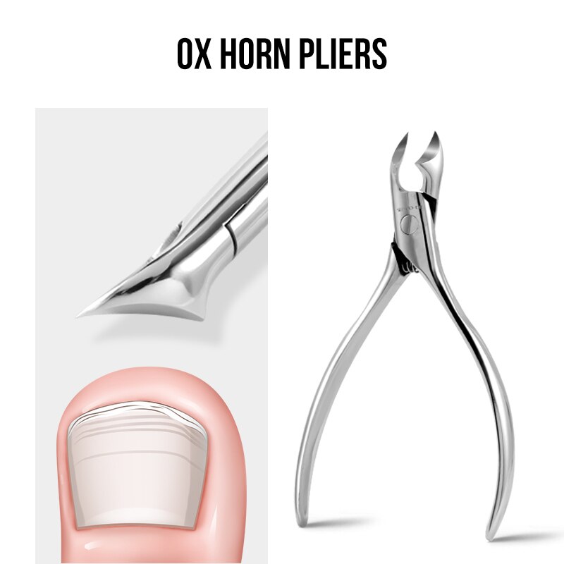 Nail Clippers Ingrown Paronychia Toenail Cutters P... – Vicedeal