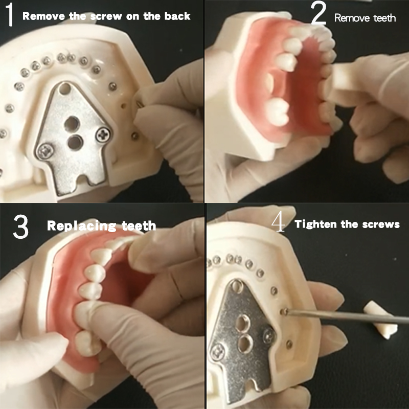 Dental Model Teeth Model Dentist Study Teaching Mo... – Grandado