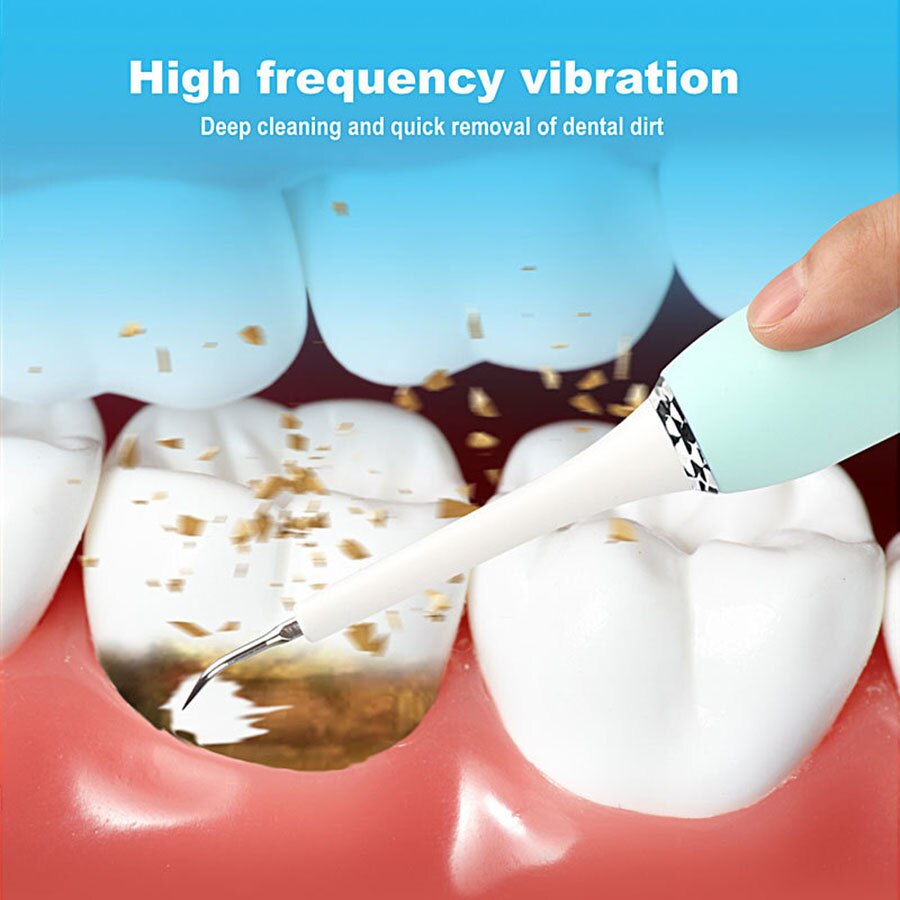 Electric Ultrasonic Calculus Remover Dental Scalin... – Vicedeal