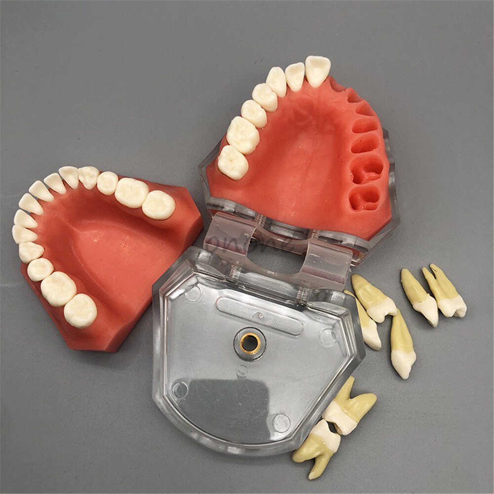 Dental Standard Model with Removable Teeth Dental ... – Vicedeal