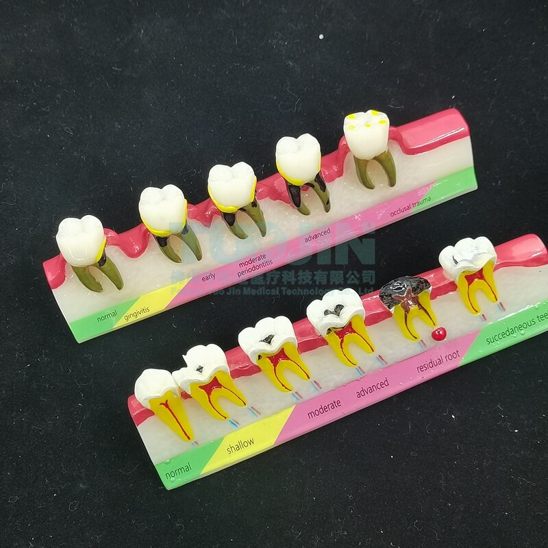 Dental Supplies Teeth Model Dental Equipment Teeth... – Grandado