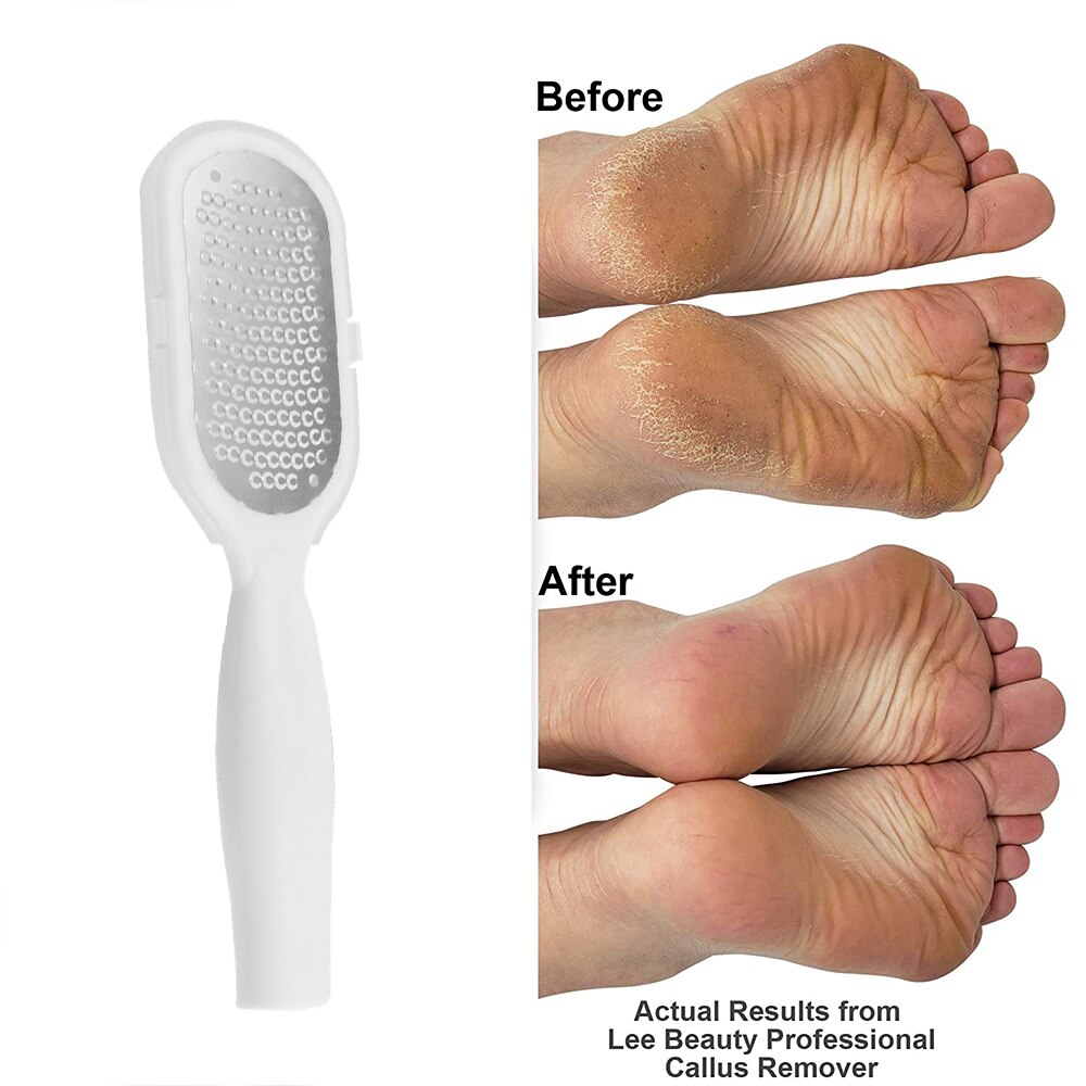 1pc Stainless Steel Foot File Scraper Callus Dead ... – Grandado