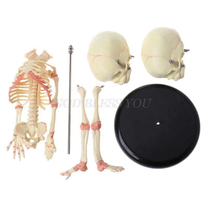 37cm Human Double Head Baby Skull Skeleton Anatomy... – Grandado