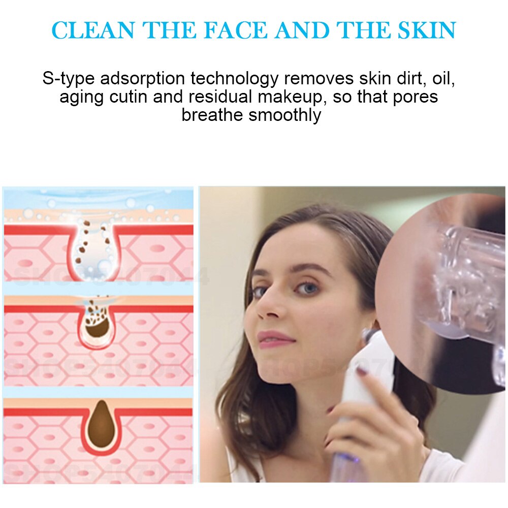 Hydrogen Oxygen Small Bubble Blackhead Remover LED... – Vicedeal