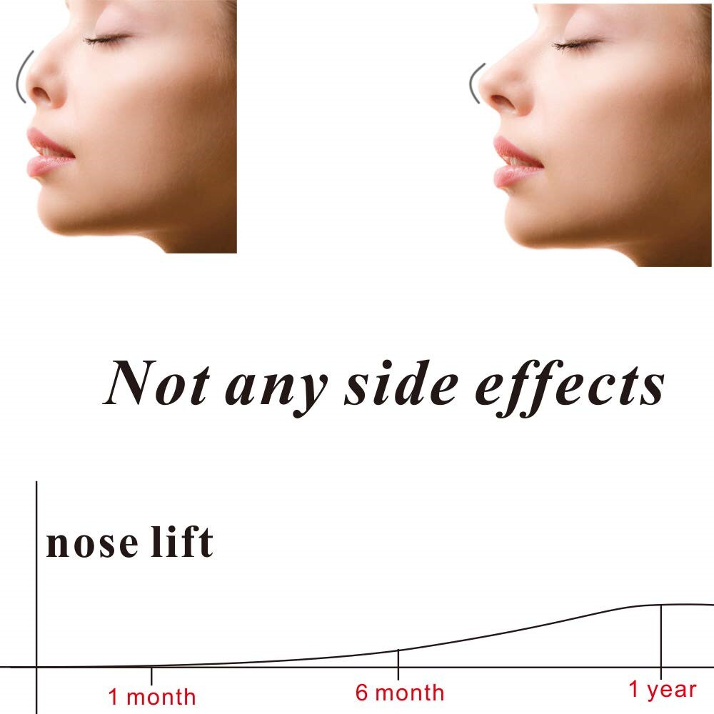 Nose Up Lifting Shaping Shaper Orthotics Clip Sili... – Grandado