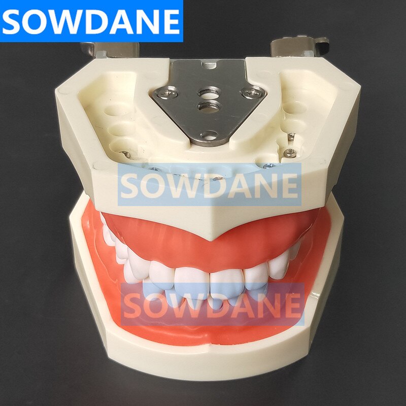 Model Dental Universal Plate Type Removable Teeth ... – Grandado