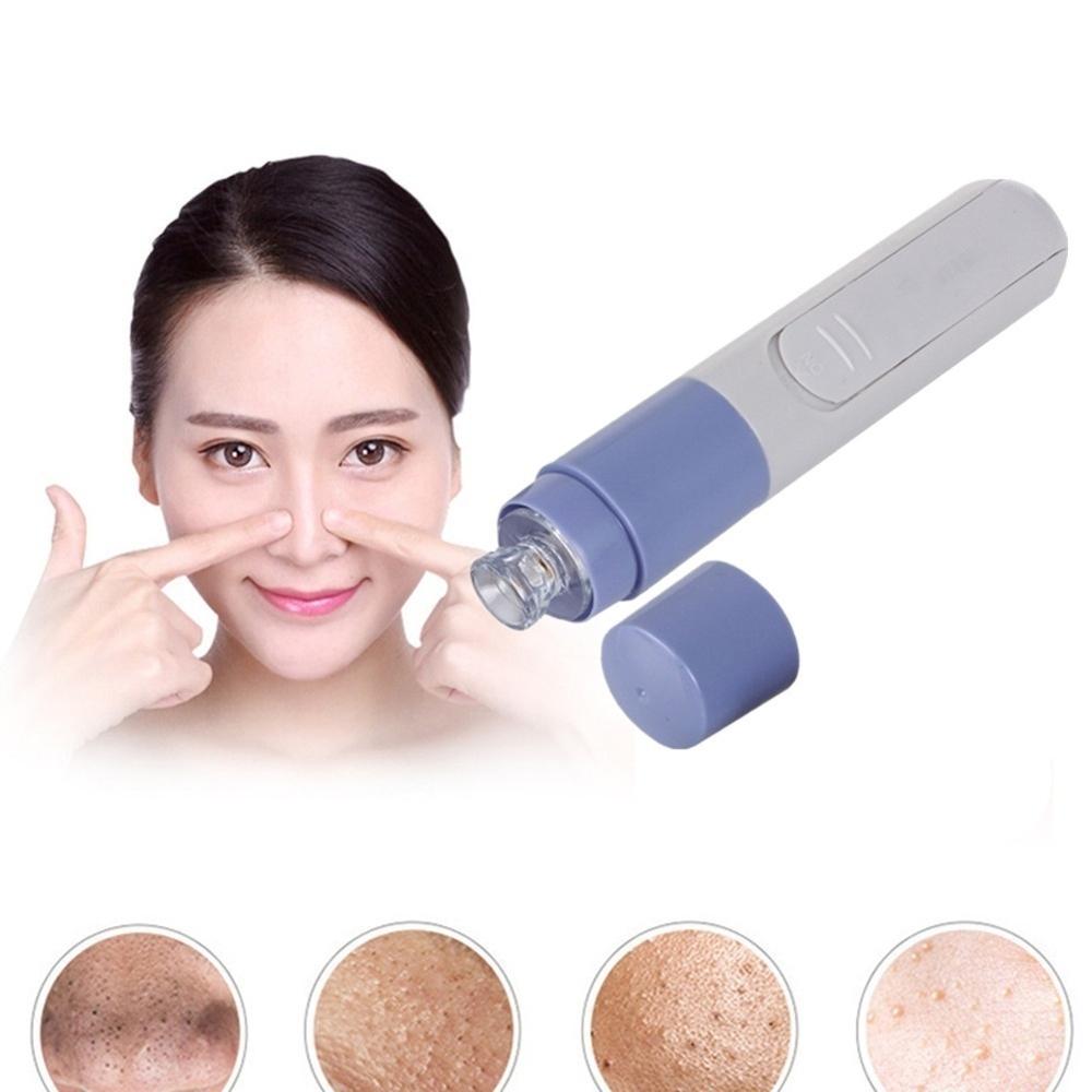 Electric Facial Pore Blackhead Cleaner Remover Vac... – Vicedeal