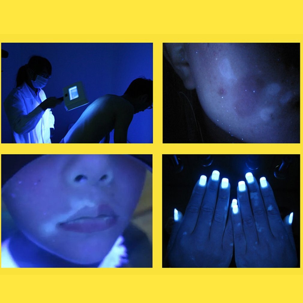 Lamp Skin UV Analyzer Facial Skin Examination Magn... – Grandado