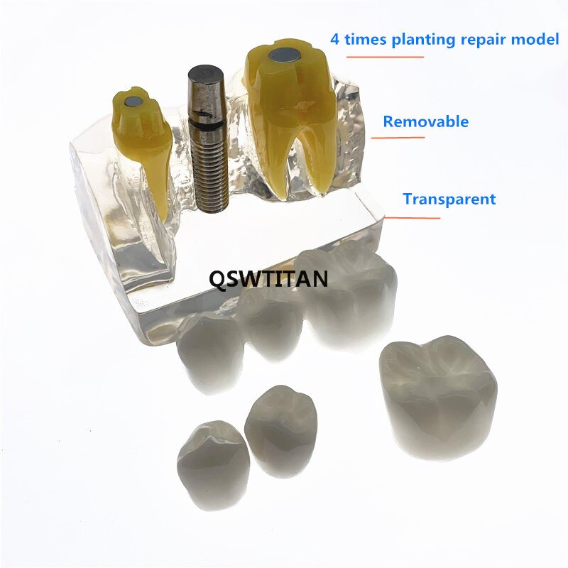 Clear Dental Demonstration Study Teeth Model for I... – Vicedeal