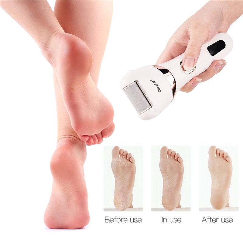 CkeyiN Electric Feet Pedicure Machine Foot Callus ... – Vicedeal