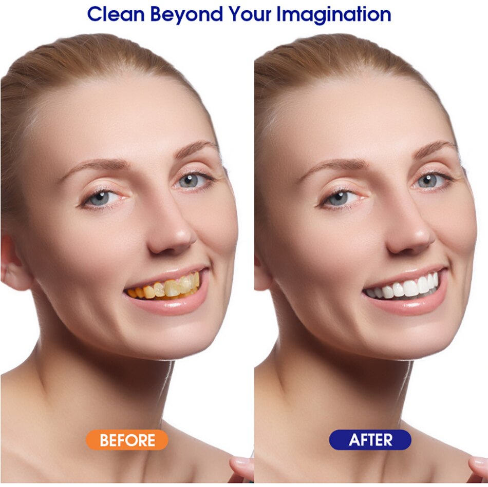 Oral Irrigator Dental Scaler Electric Sonic Tooth ... – Grandado