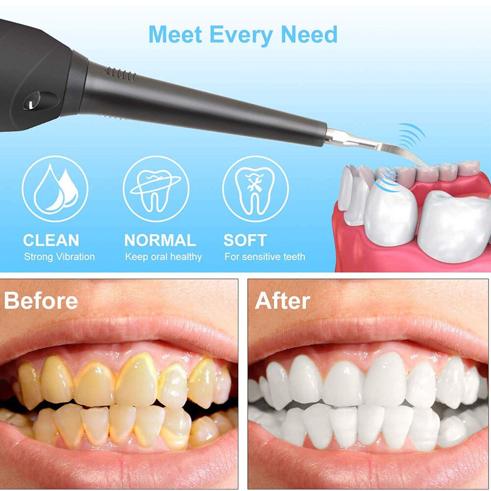 Electric Ultrasonic Sonic Dental Scaler Tooth Calc... – Grandado