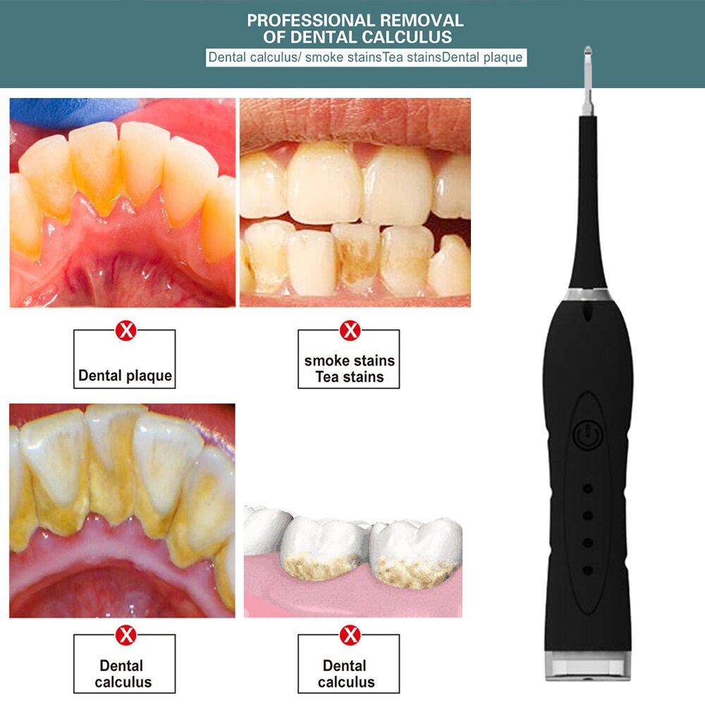 Portable Electric Dental Scaler Clean Tooth Travel... – Grandado