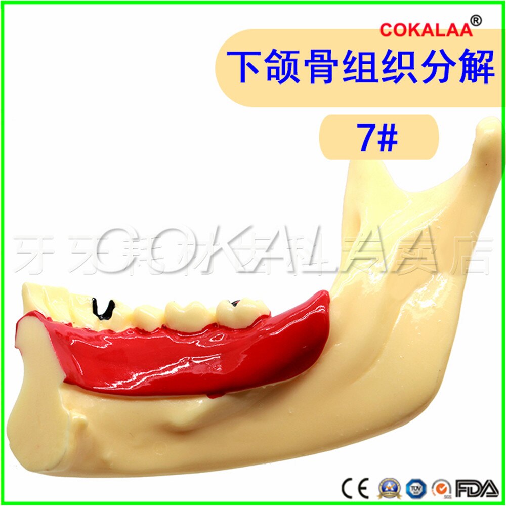Good Mandibular tissue decomposition model dental ... – Vicedeal