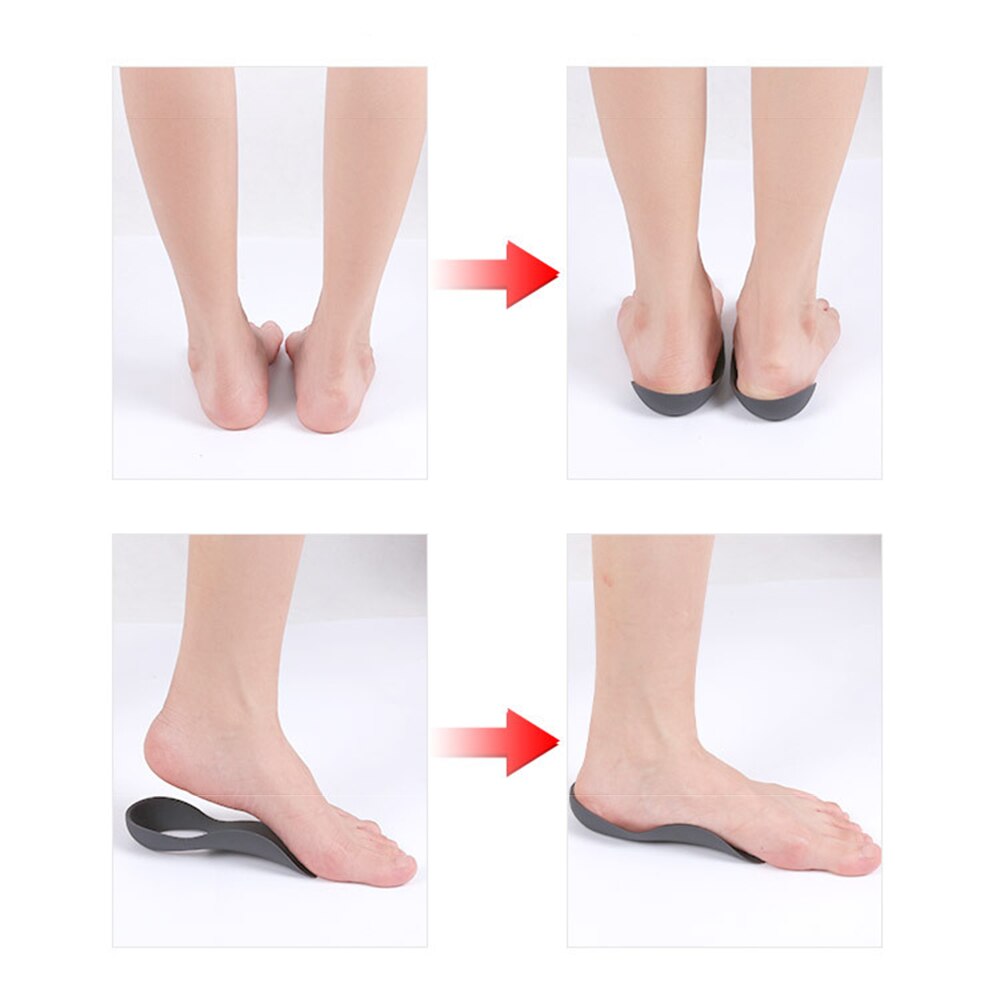 1Pair Flat Foot Orthopedic Insole Plantar Fascia A... – Vicedeal