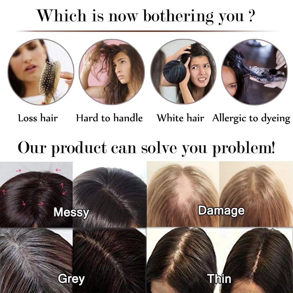 Antoniah Topper Clip-in Hair High Temperature Fibe... – Grandado