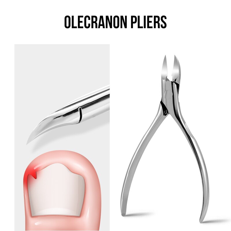 Nail Clippers Ingrown Paronychia Toenail Cutters P... – Vicedeal