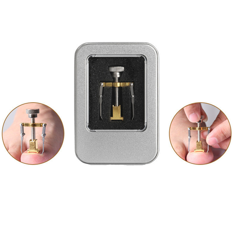 1PC Eingewachsene Kappe Nagel Erholen Werkzeug Ped... – Vicedeal