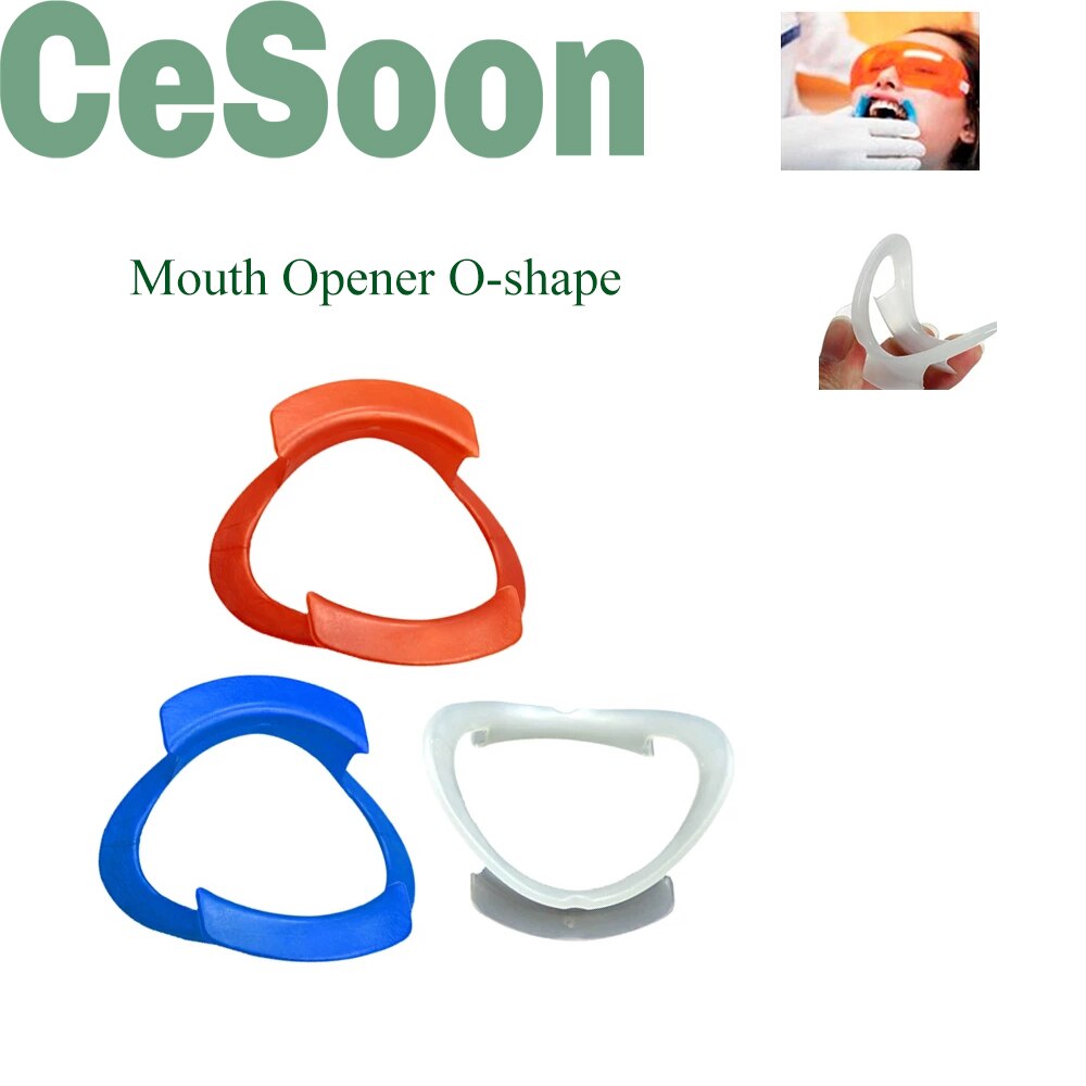 O-Vorm Dental Mond Expander Intraoral Plastic Chee... – Vicedeal