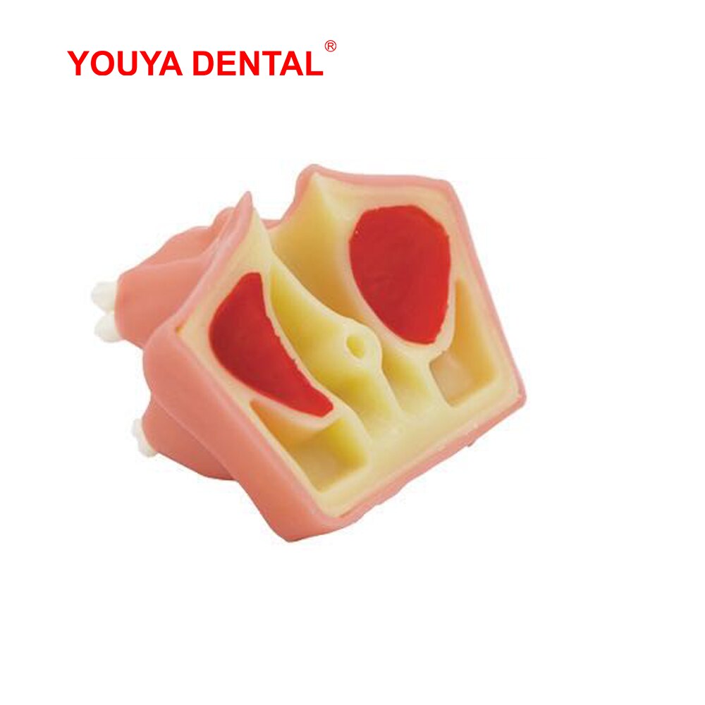 Dental Model Teeth Implant Practice Model Maxillar... – Grandado