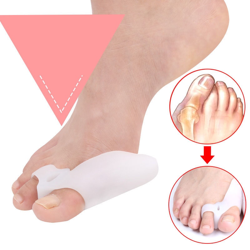 5pc/Sets Toe Ectropion Correct Organ Suit Toe Sepa... – Grandado