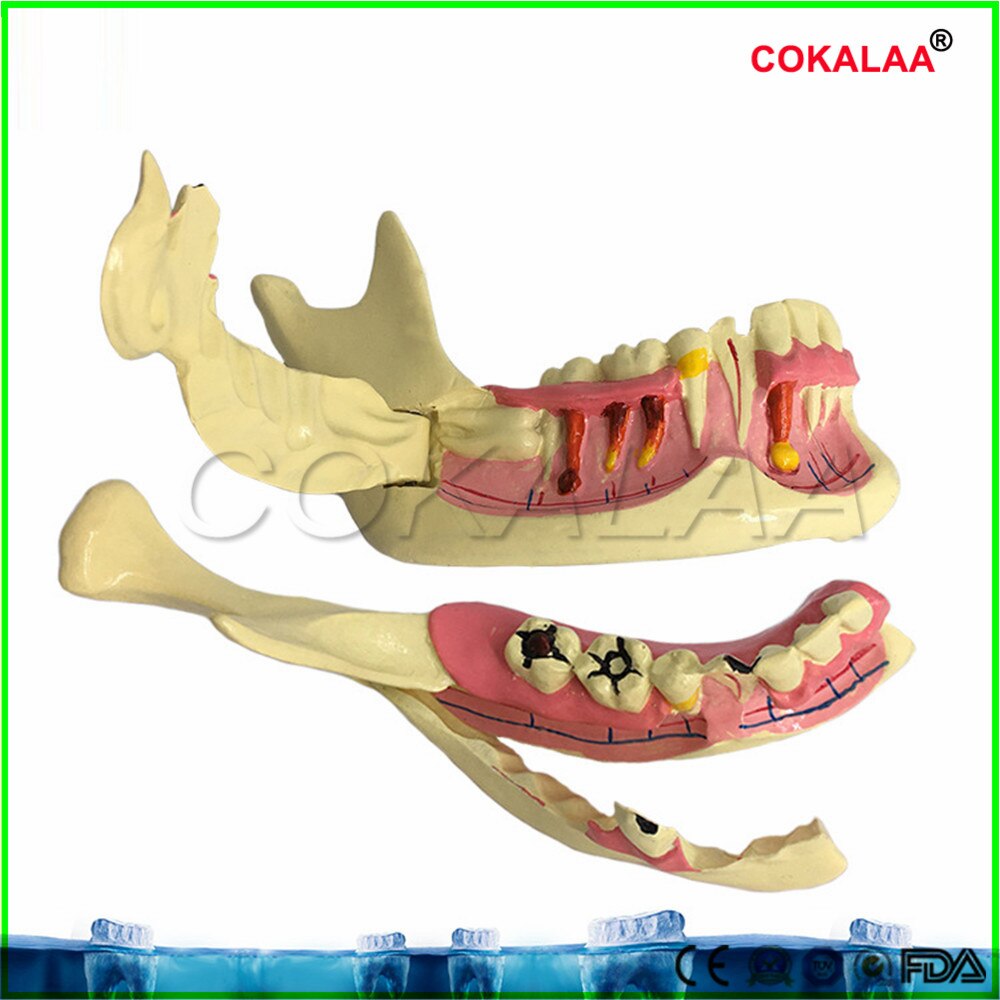 Good Mandibular tissue decomposition model dental ... – Vicedeal