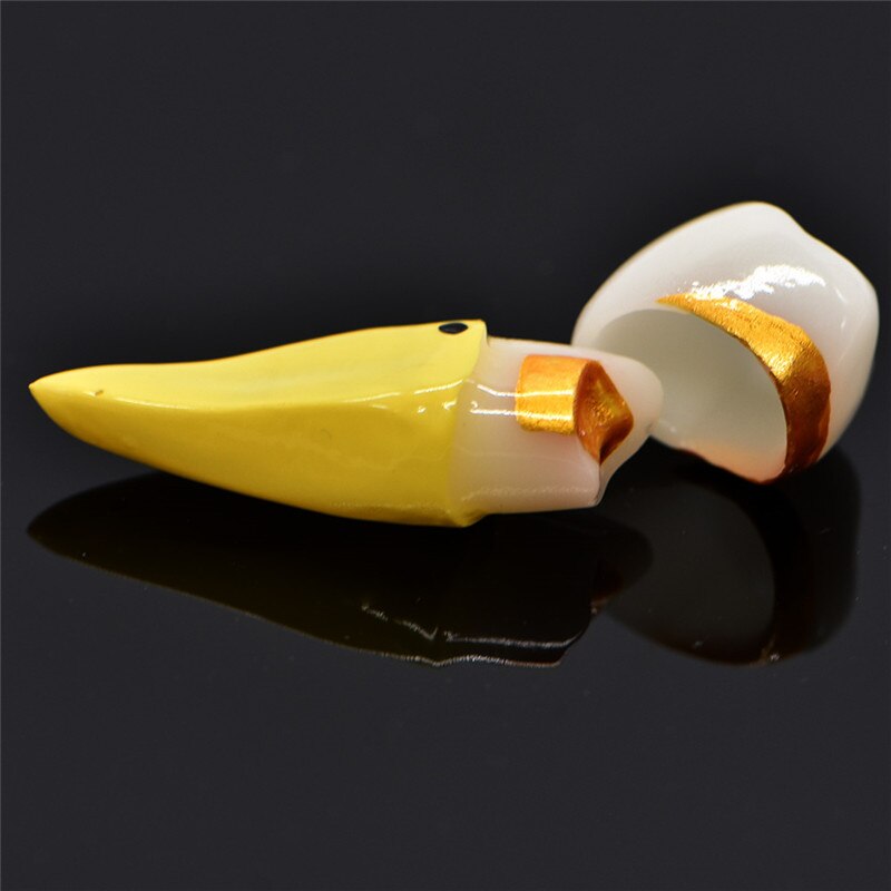 Dental Pulp Restoration Pathological Model with De... – Vicedeal