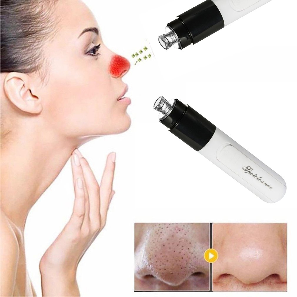 Electric Facial Pore Cleanser Spot Cleaner Face Bl... – Grandado