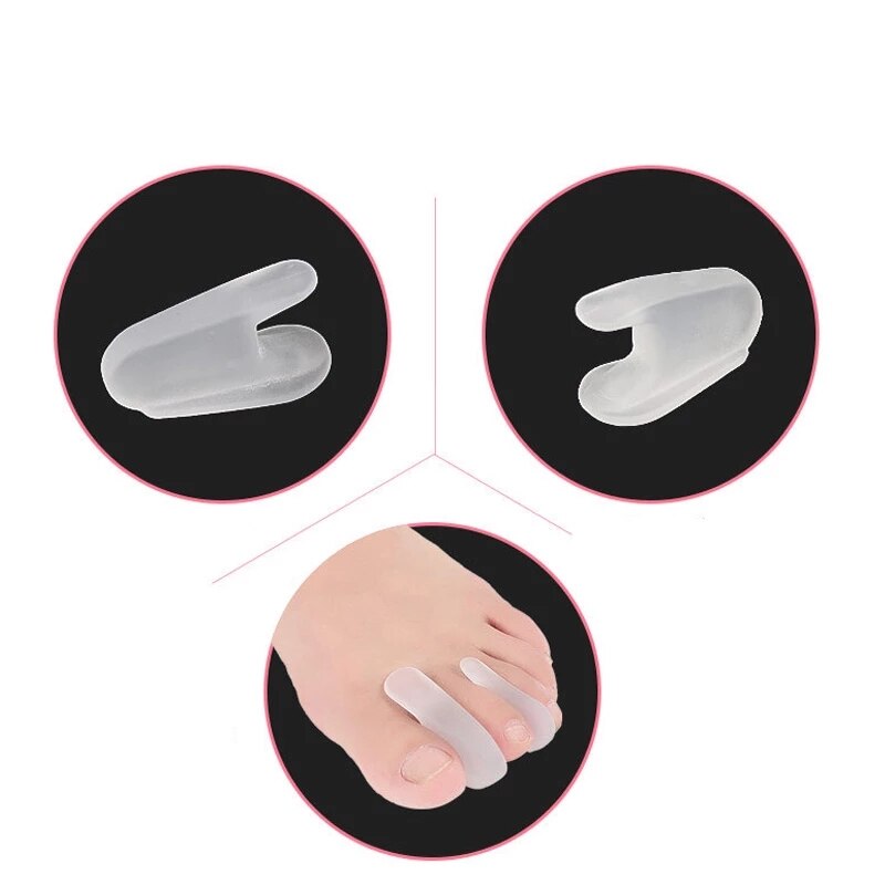 1-2Pair A-Shaped Toe Thumb Straightener Hammer Hal... – Vicedeal
