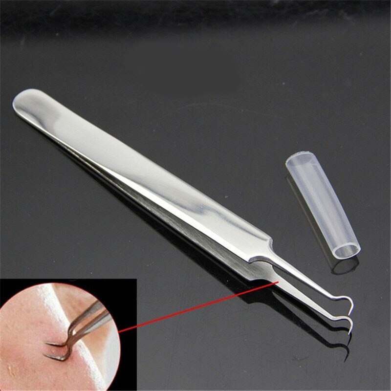 1Pcs Blackhead Tweezers Nipper Antacid Steel Needl... – Vicedeal