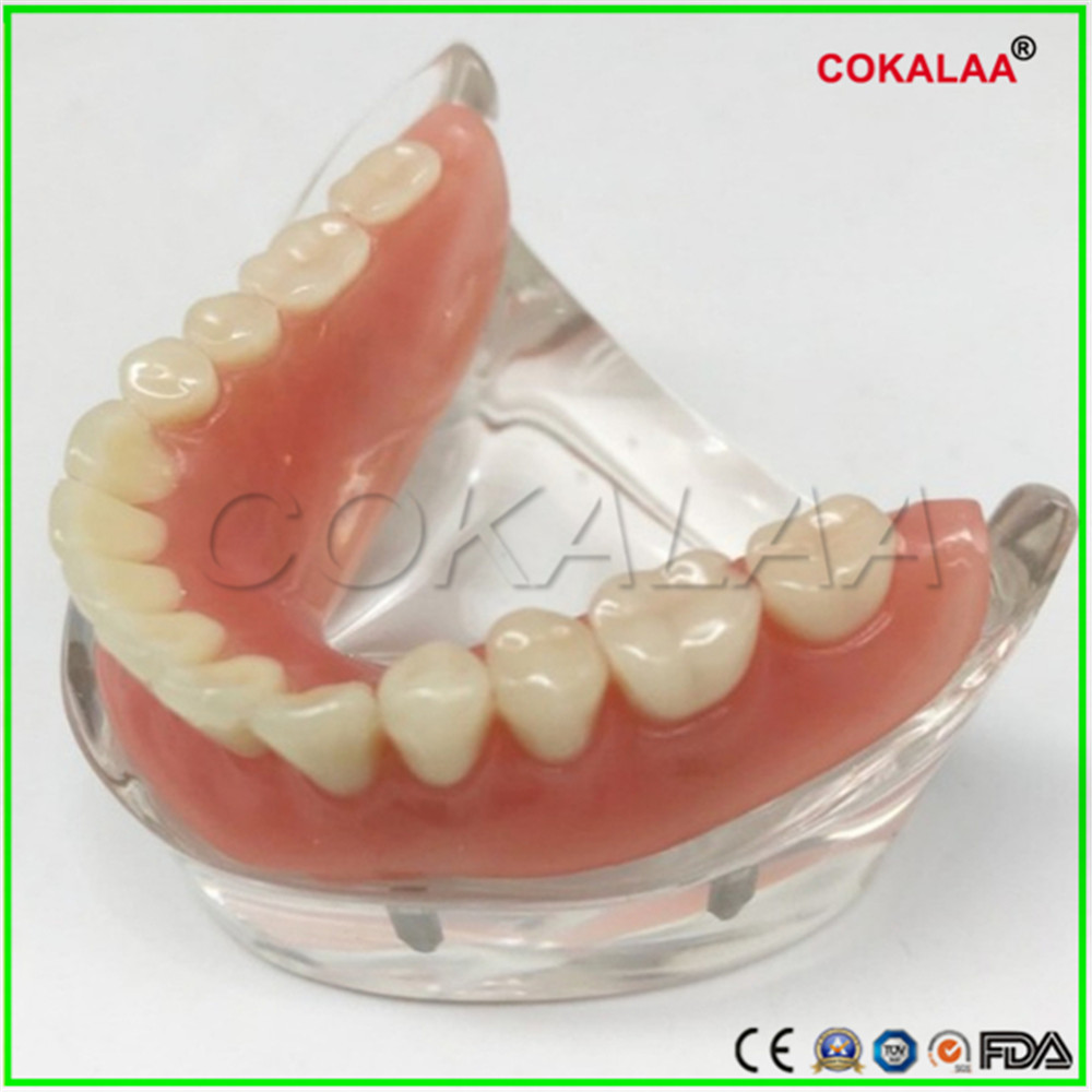 Good 4 nails Mandibular model dental lower jaw imp... – Grandado