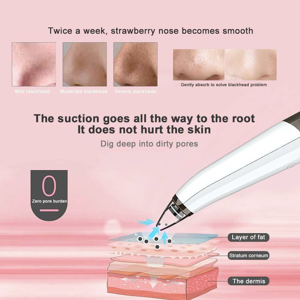6-in-1 Blackhead Remover Blackhead Acne with 6 Tip... – Grandado