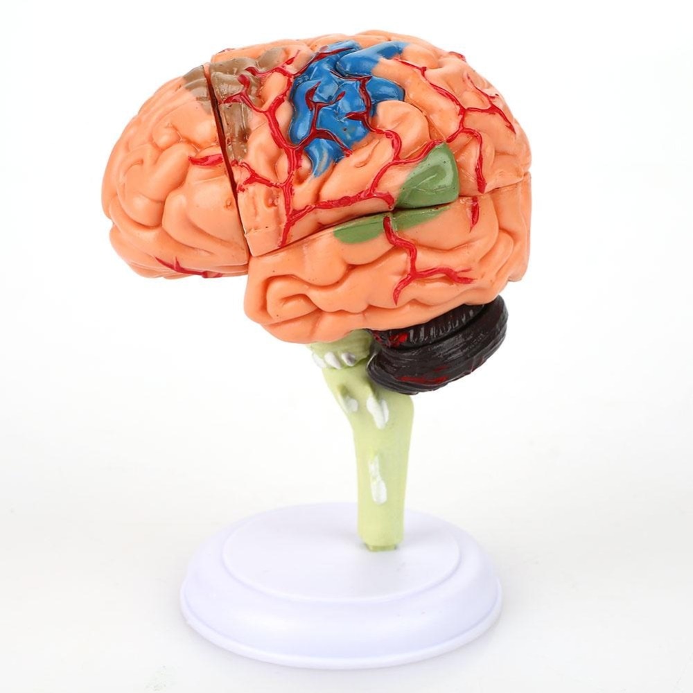 4D Gedemonteerd Anatomisch Brain Model Van Menseli... – Vicedeal