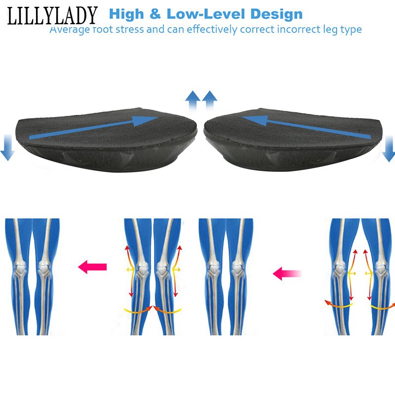 O/X Leg For Women Man Silicon Gel Valgus Varus Cor... – Grandado