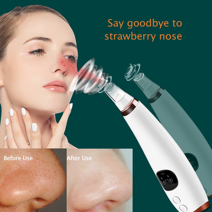 Blackhead Remover Facial Pore Clean Acne Extractor... – Grandado